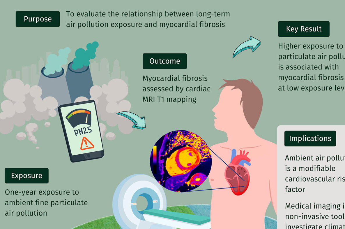 MRI study finds even low air pollution levels may harm heart health ...